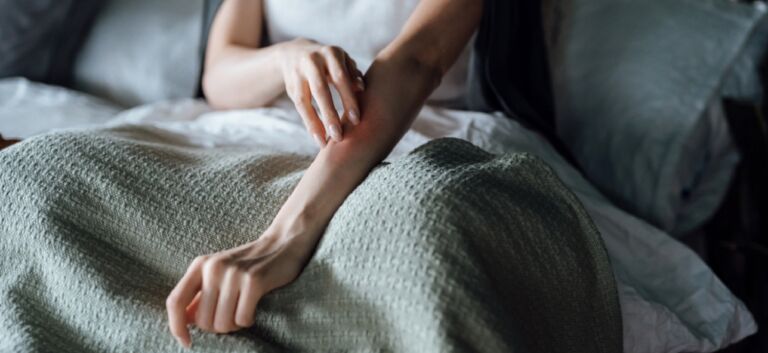 Smetplekken: van de oorzaken en symptomen tot advies