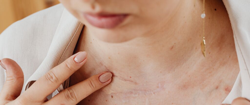 Littekenverzorging: Tips voor genezing en vermindering