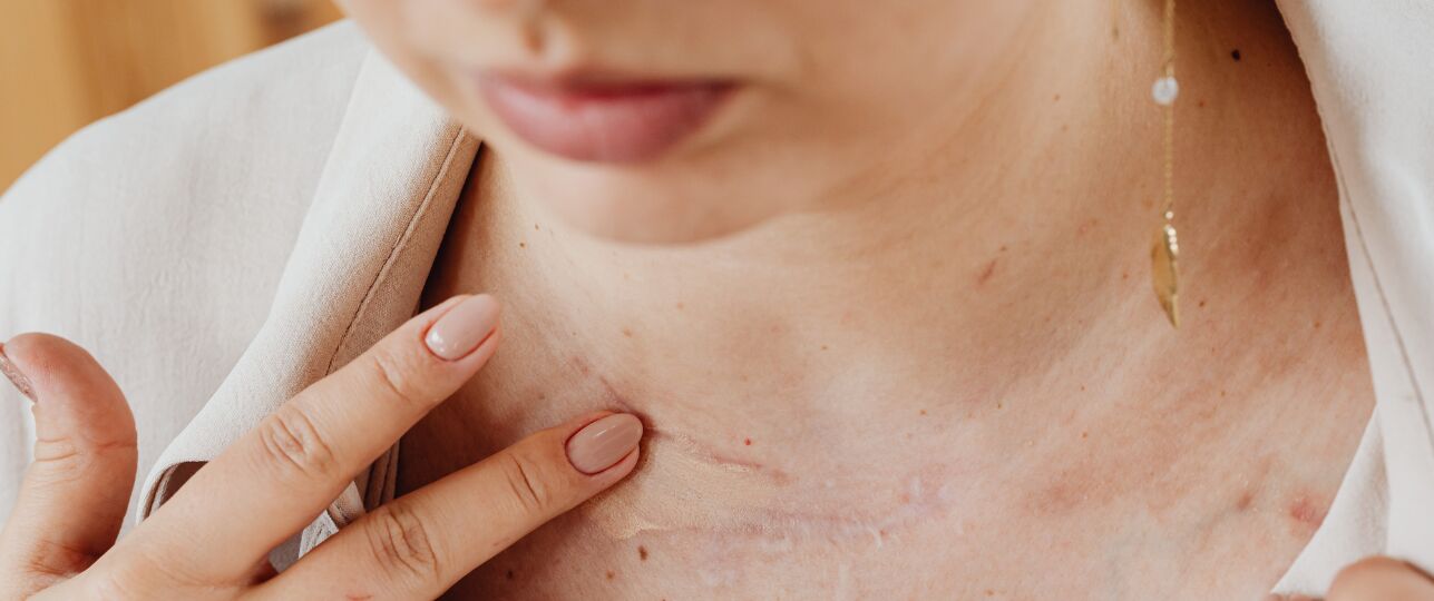 Littekenverzorging: Tips voor genezing en vermindering